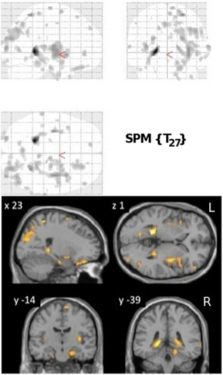 Frontiers | The relationship of topographical memory performance to ...