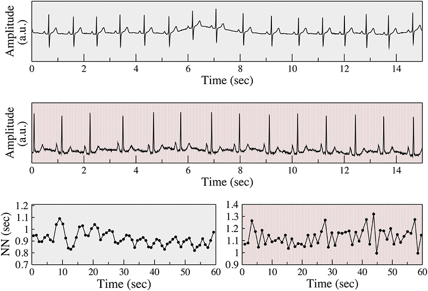 Frontiers | Heart Rate Fragmentation: A New Approach to the Analysis of ...