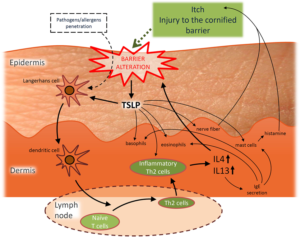Frontiers | Atopic Dermatitis Studies through In Vitro Models
