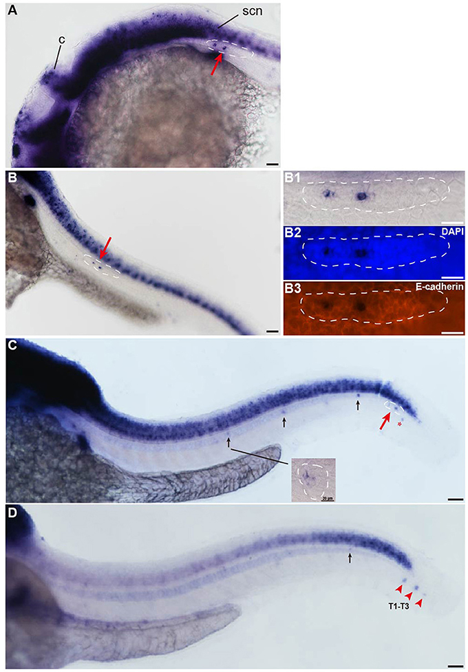 Frontiers | Insm1a Is Required for Zebrafish Posterior Lateral Line ...