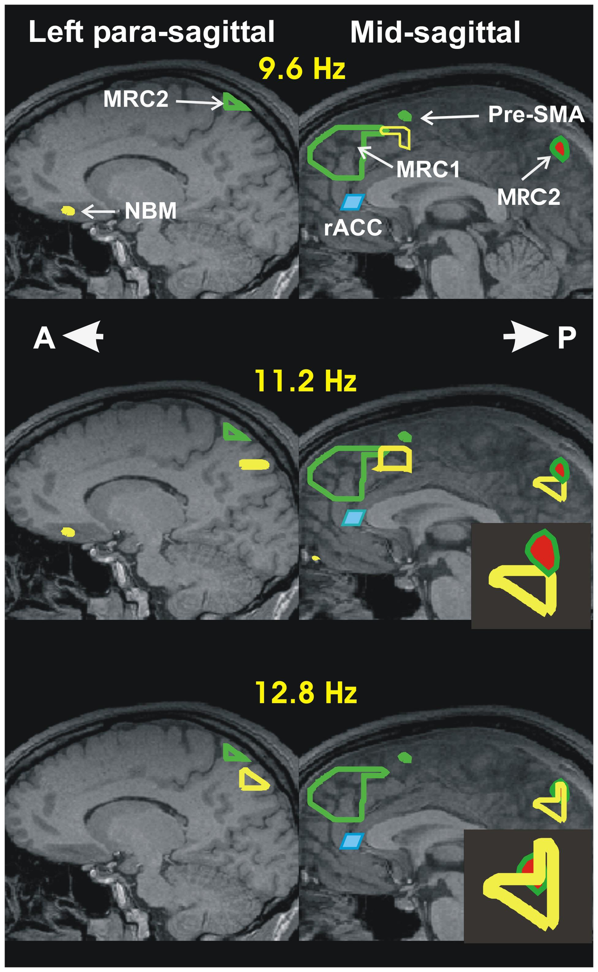 Frontiers | Neurofeedback and the Neural Representation of Self ...