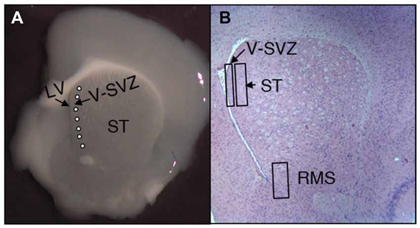 Frontiers | Embryonic Cerebrospinal Fluid Increases Neurogenic Activity ...