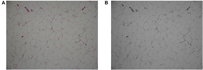 Frontiers | AdipoCount: A New Software for Automatic Adipocyte Counting