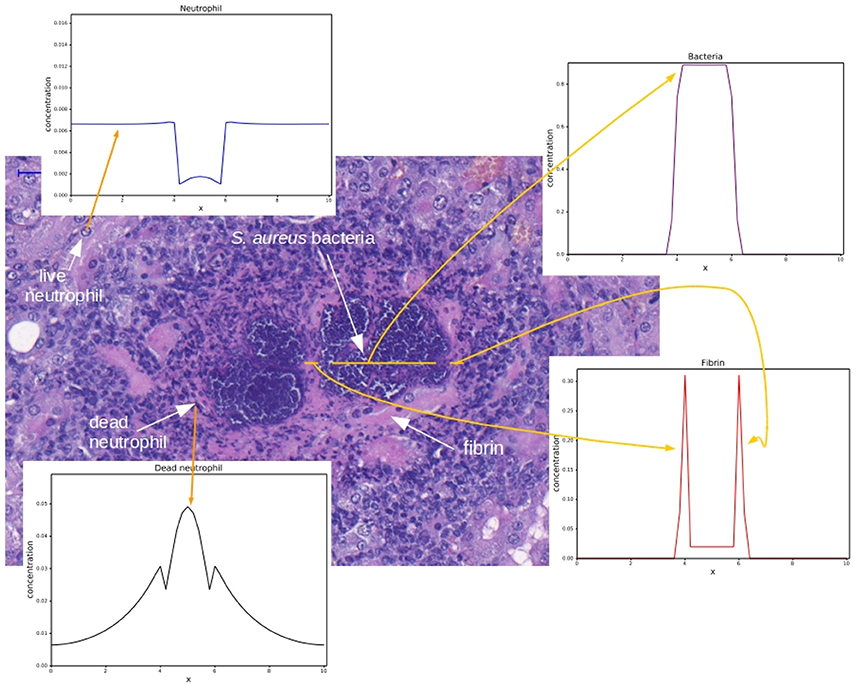 Frontiers | Development of a Computational Model of Abscess Formation