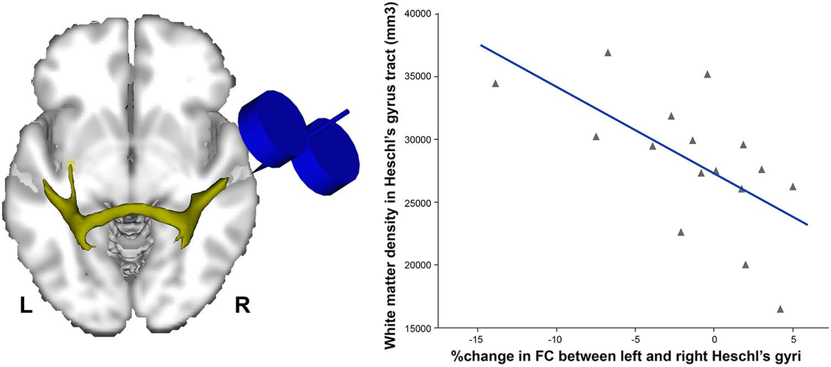 Frontiers | Insights Into Auditory Cortex Dynamics From Non-invasive ...