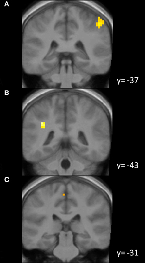 Frontiers | Dual processing streams in chemosensory perception