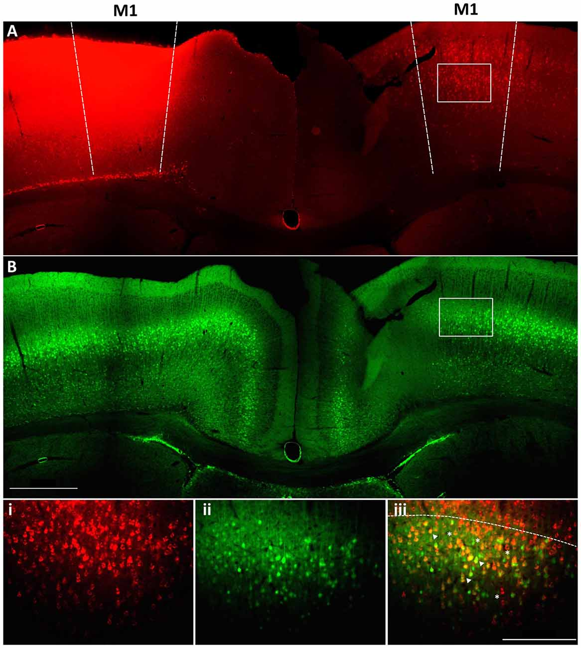 Frontiers | Transcriptome Profiling of Layer 5 Intratelencephalic Projection Neurons From the ...