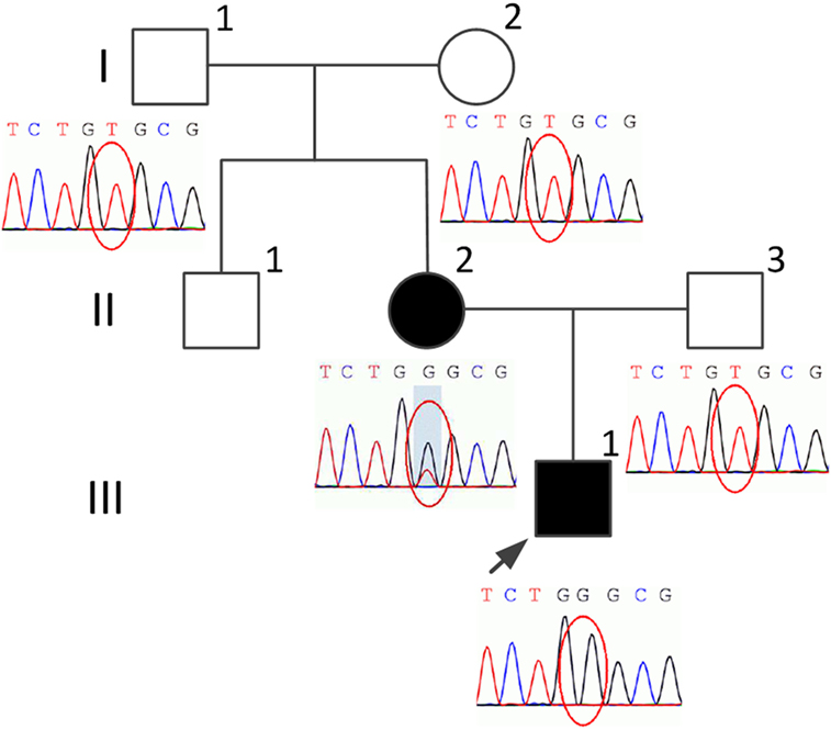 Frontiers | A Novel Variant in ABCD1 Gene Presenting as Adolescent ...