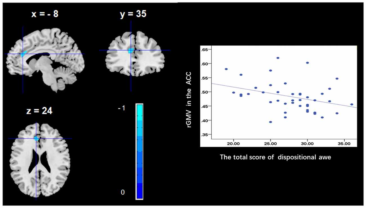 Frontiers | Neural Basis of Dispositional Awe