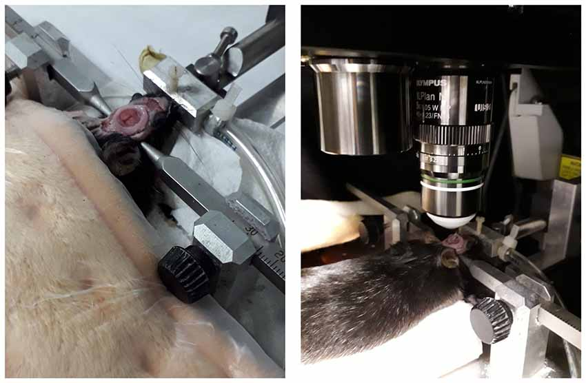 Frontiers | In Vivo Imaging of Microglia With Multiphoton Microscopy