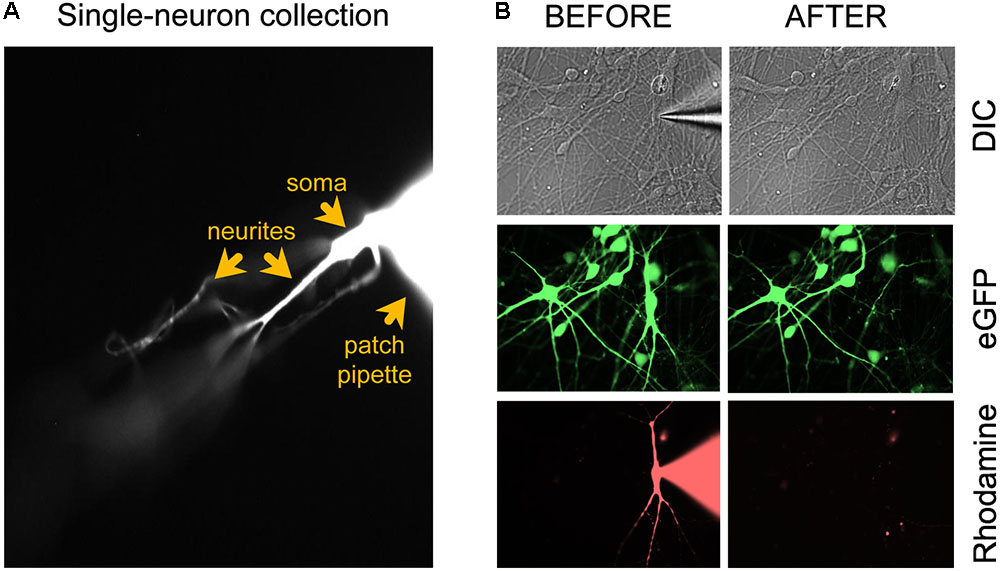 Frontiers | Patch-Seq Protocol to Analyze the Electrophysiology ...