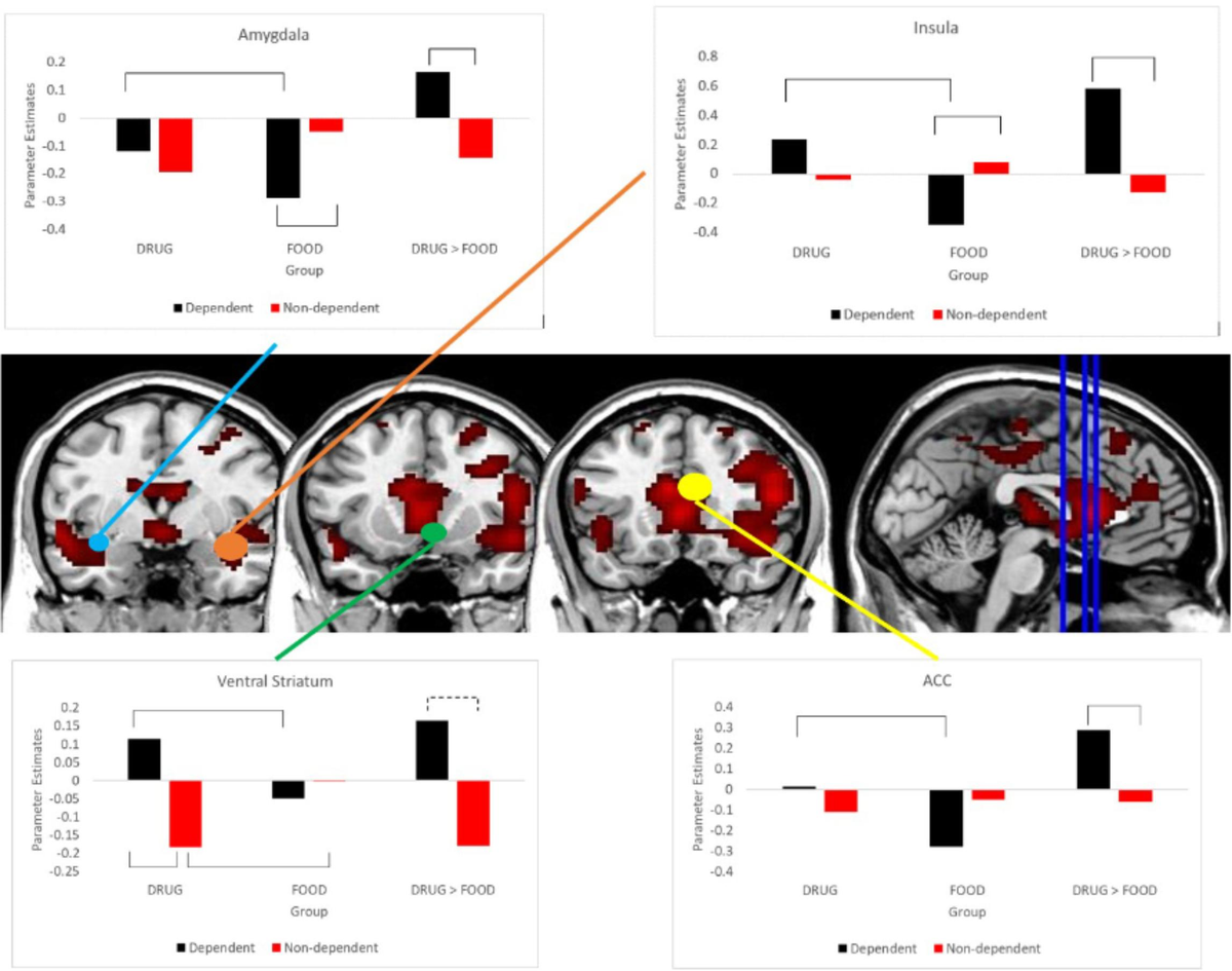 Frontiers | Neuroimaging Metrics of Drug and Food Processing in Cocaine ...