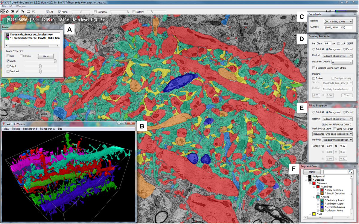 Frontiers | VAST (Volume Annotation and Segmentation Tool): Efficient Manual and Semi-Automatic ...