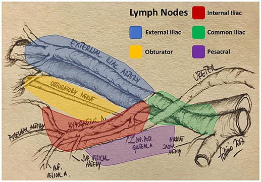 Frontiers | The Role of Lymph Node Dissection in the Treatment of ...