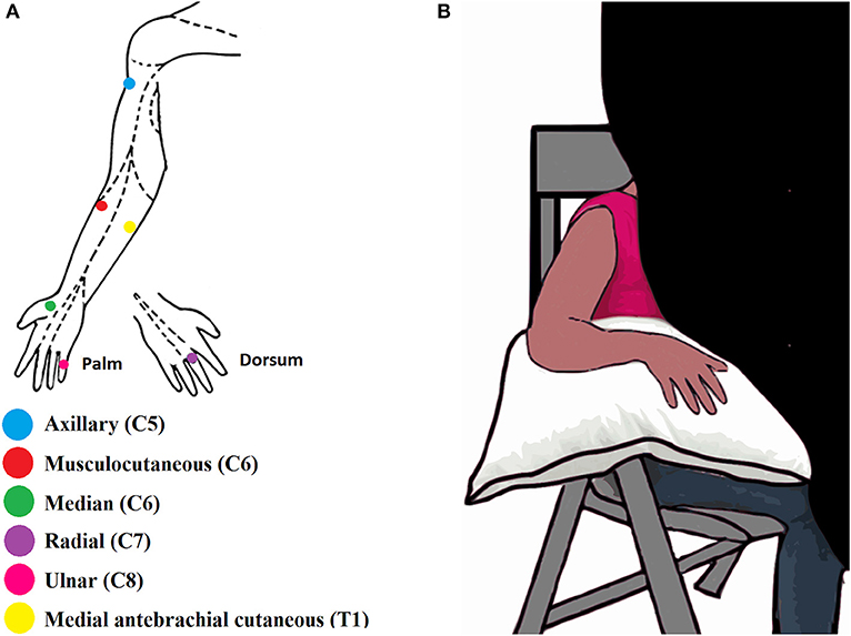 Frontiers | Unilateral Brachial Plexus Lesion Impairs Bilateral Touch ...