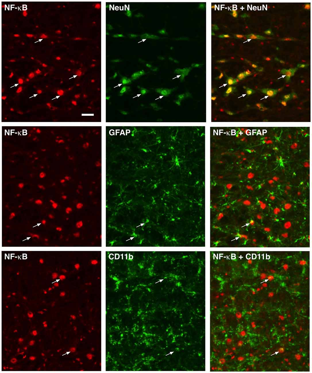 Frontiers | NF-KappaB Pathway Is Involved in Bone Marrow Stromal Cell ...