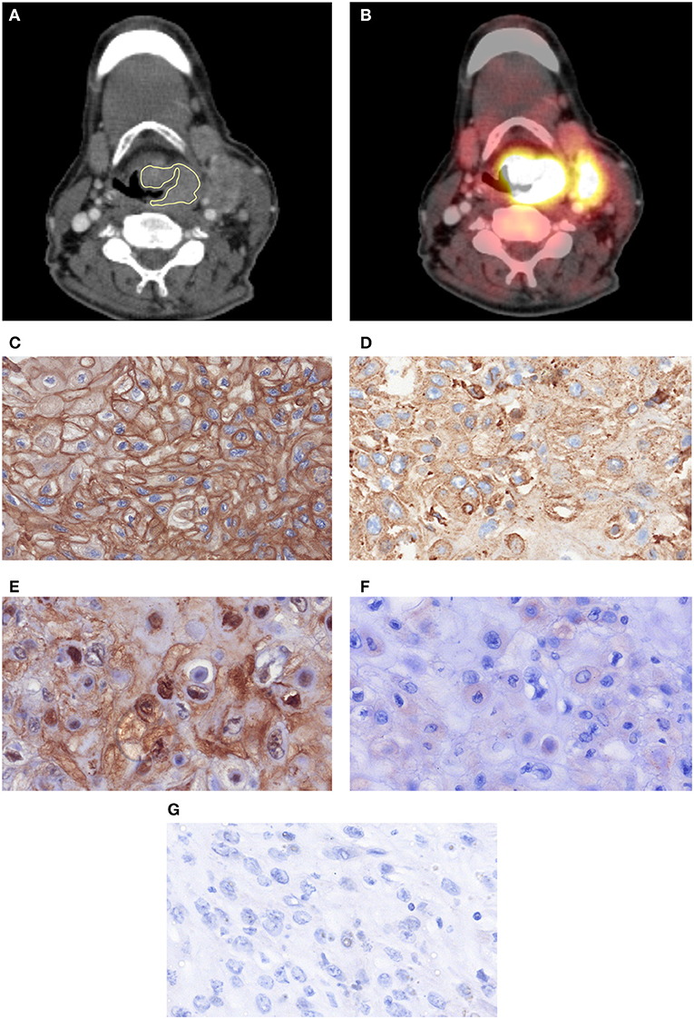 Frontiers | CT Texture Analysis—Correlations With Histopathology ...