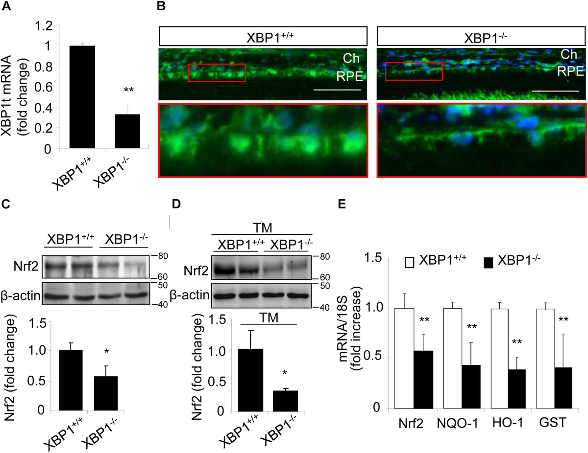 Frontiers | Regulation of Nrf2 by X Box-Binding Protein 1 in Retinal ...