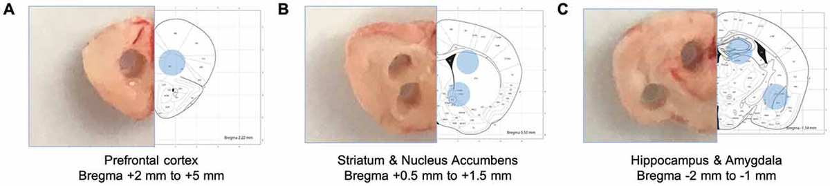 Frontiers | Commonly Used Anesthesia/Euthanasia Methods for Brain ...
