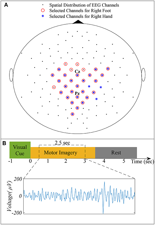 Frontiers | Wavelet Entropy-Based Inter-subject Associative Cortical Source Localization for ...