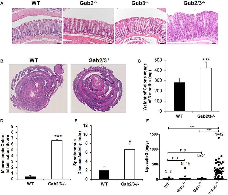 Frontiers | Gab2 and Gab3 Redundantly Suppress Colitis by Modulating ...