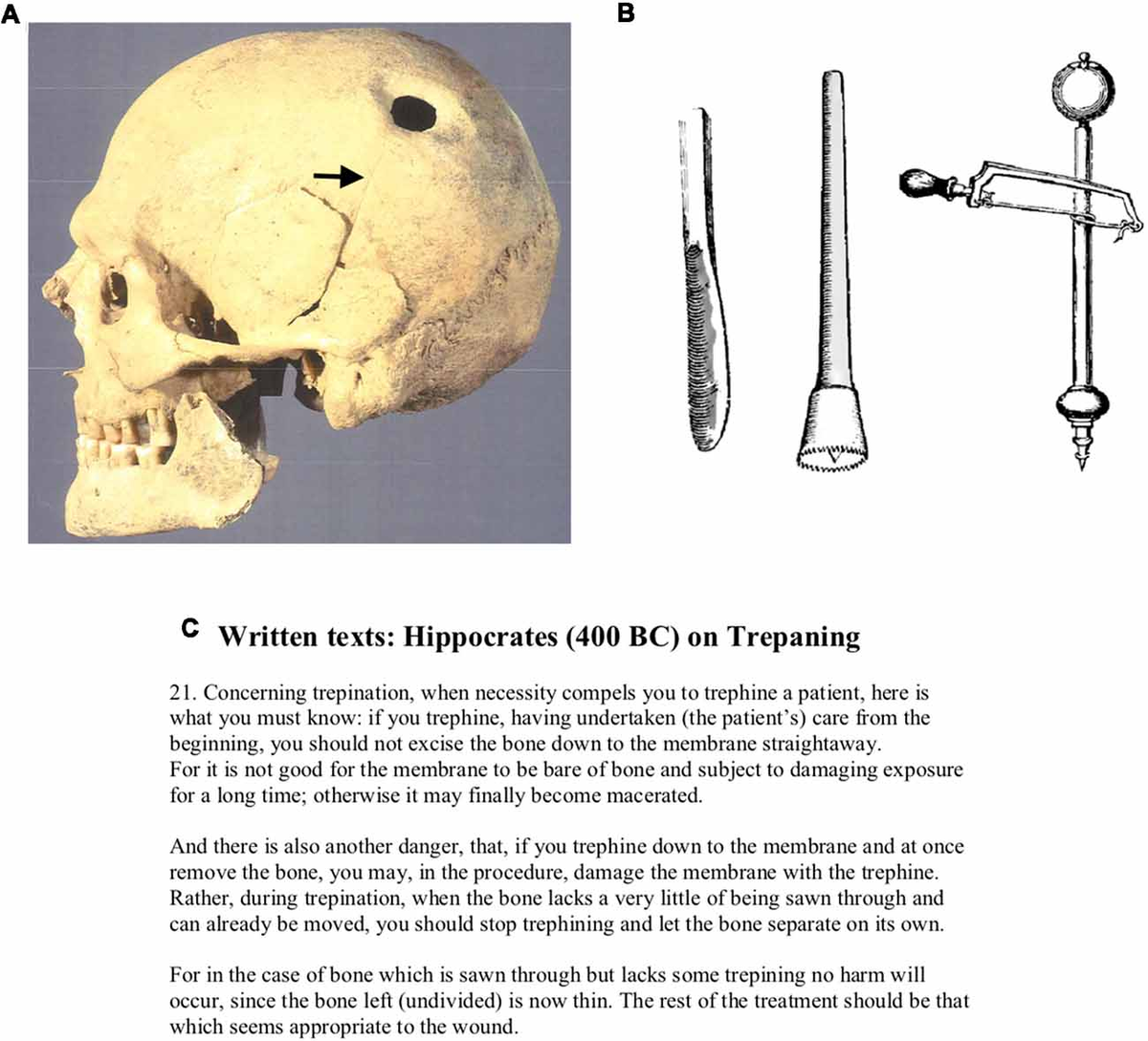 Frontiers | Why Study the History of Neuroscience?