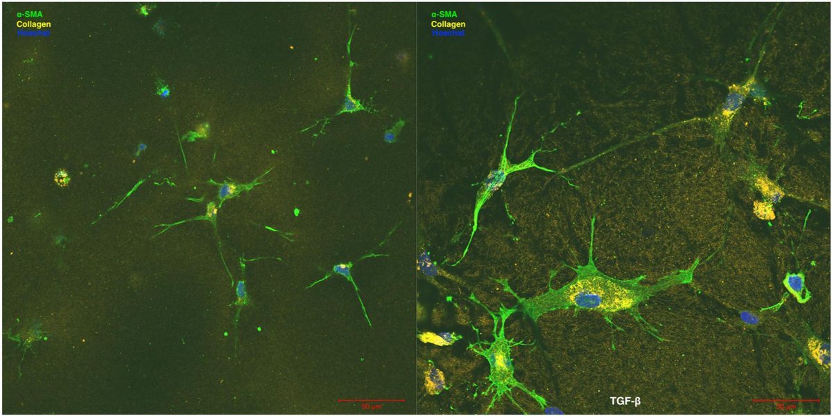 Frontiers | Acellular Extracellular Matrix Bioscaffolds for Cardiac ...