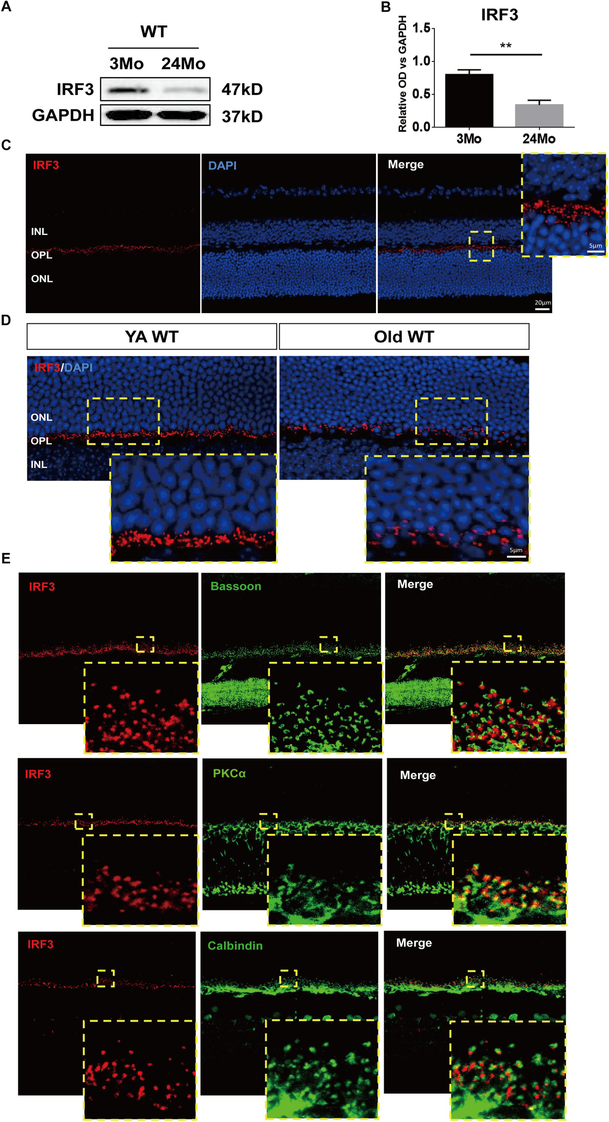 Frontiers | Interferon Regulatory Factor 3 Deficiency Induces Age ...