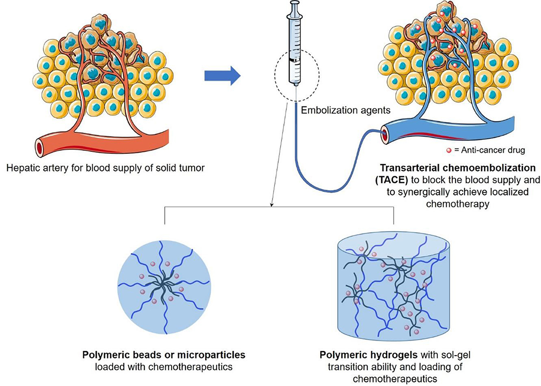Frontiers | Recent Advances on Polymeric Beads or Hydrogels as ...
