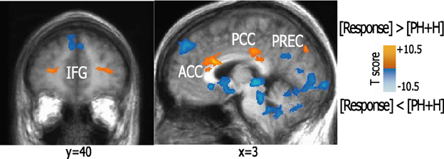 Frontiers | How the brain heals emotional wounds: the functional ...