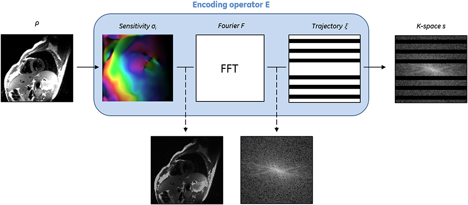 Frontiers | From Compressed-Sensing to Artificial Intelligence-Based ...