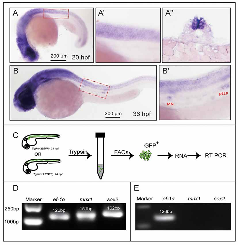 Frontiers | The Requirement of Sox2 for the Spinal Cord Motor Neuron ...
