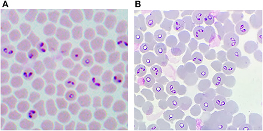 Frontiers | An Overview of Current Knowledge on in vitro Babesia ...