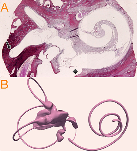 Frontiers | Computing Endolymph Hydrodynamics During Head Impulse Test ...