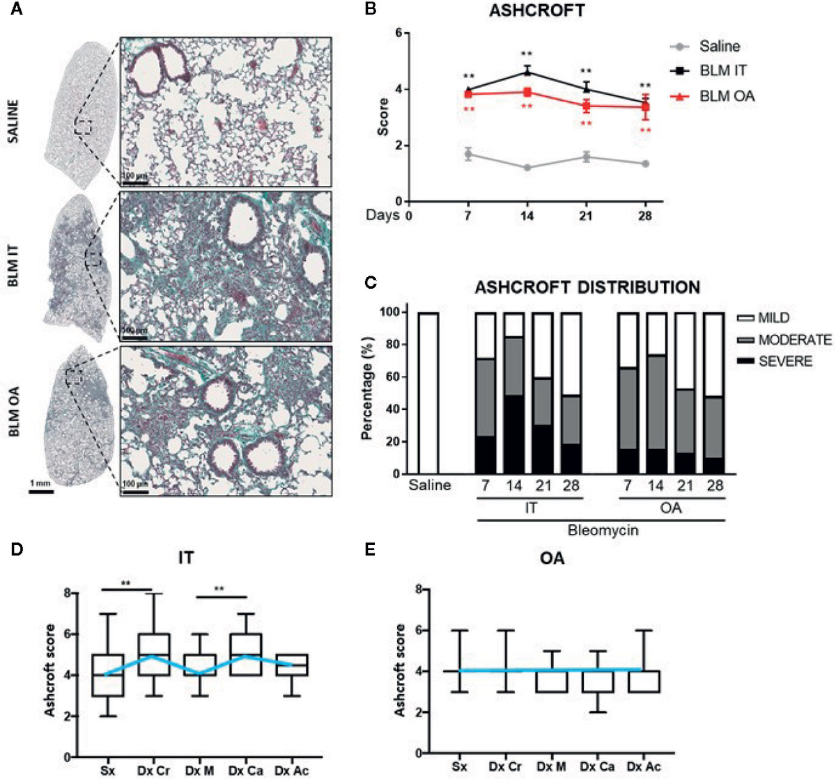 Frontiers | Quantification of Lung Fibrosis in IPF-Like Mouse Model and ...