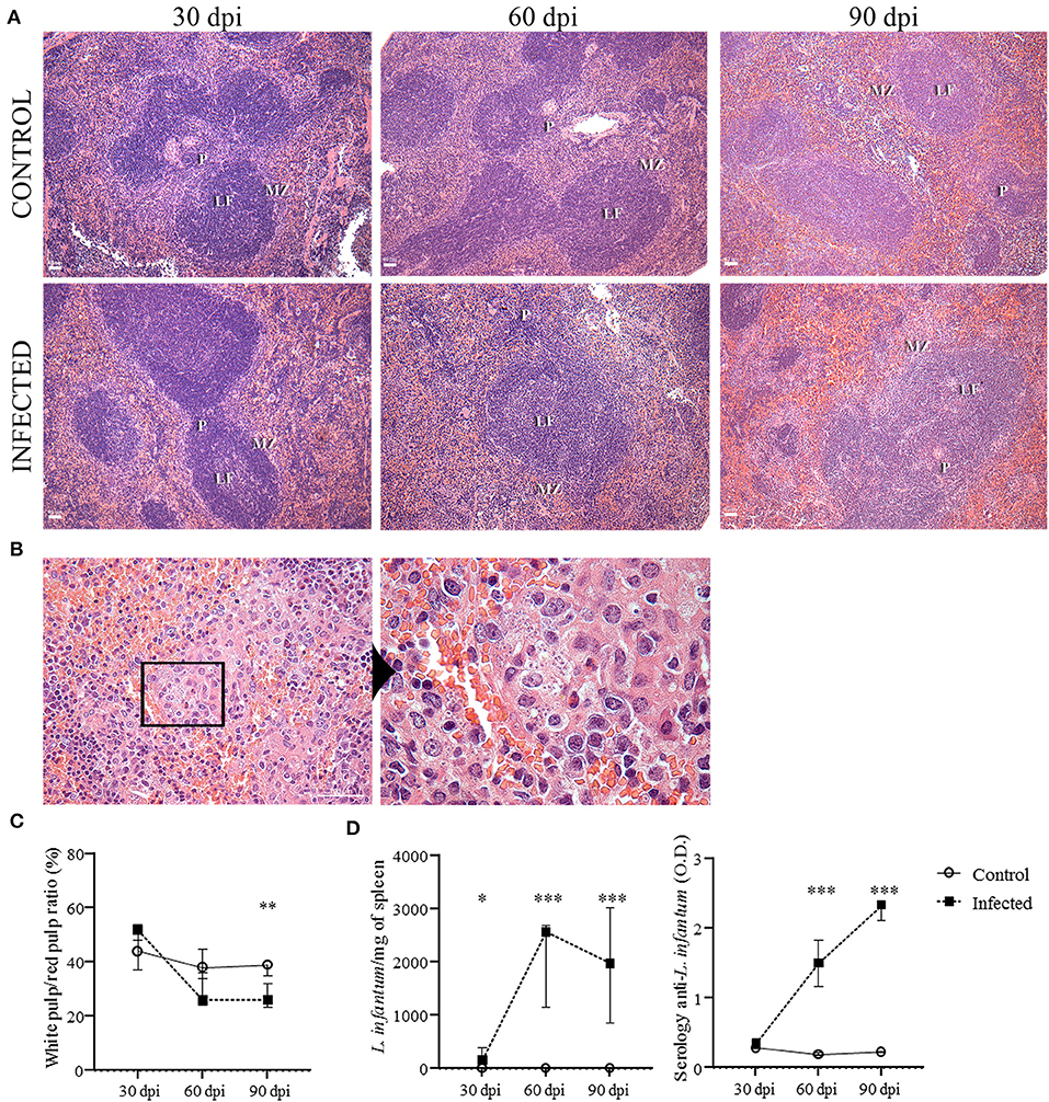 Frontiers | Phenotypical Characterization of Spleen Remodeling in ...