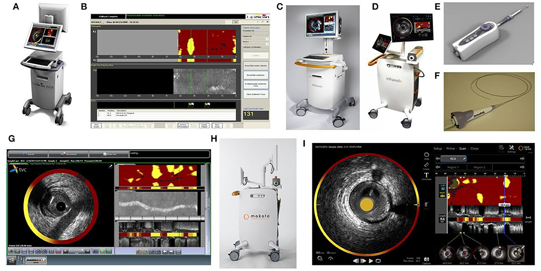 Frontiers | Near-Infrared Spectroscopy Intravascular Ultrasound Imaging ...