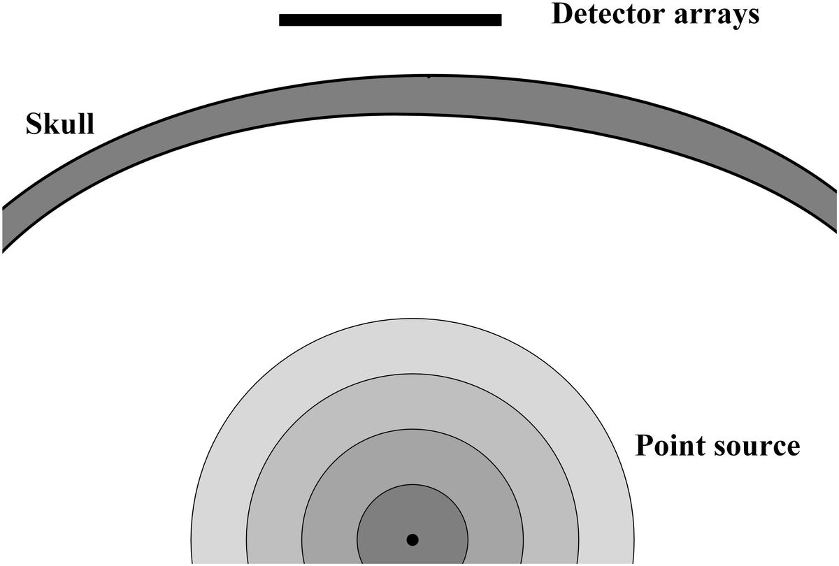 Frontiers | Numerical Evaluation of the Influence of Skull ...
