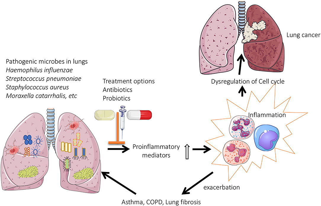 Frontiers | Role of Lung Microbiome in Innate Immune Response ...