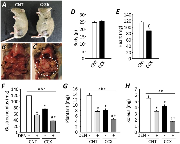 Frontiers | Cancer Cachexia Induces Preferential Skeletal Muscle Myosin ...