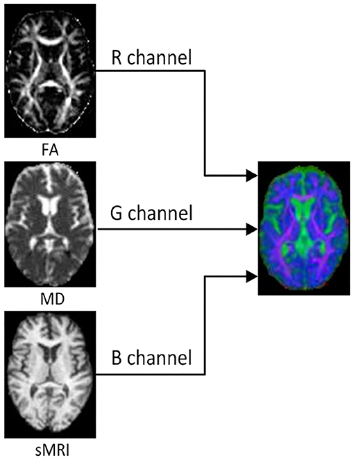 Frontiers | Identifying Early Mild Cognitive Impairment by Multi ...