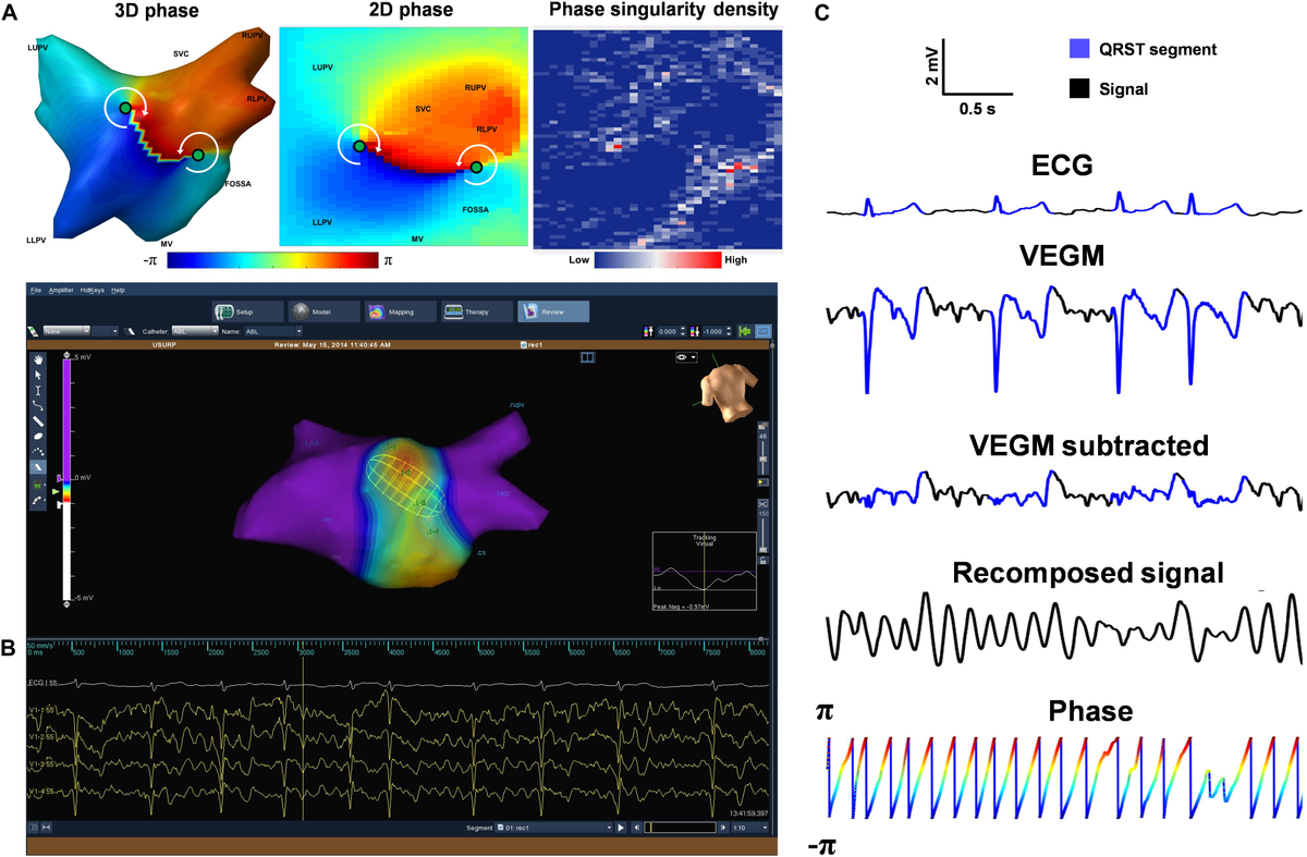 Frontiers | Standardizing Single-Frame Phase Singularity Identification Algorithms and ...