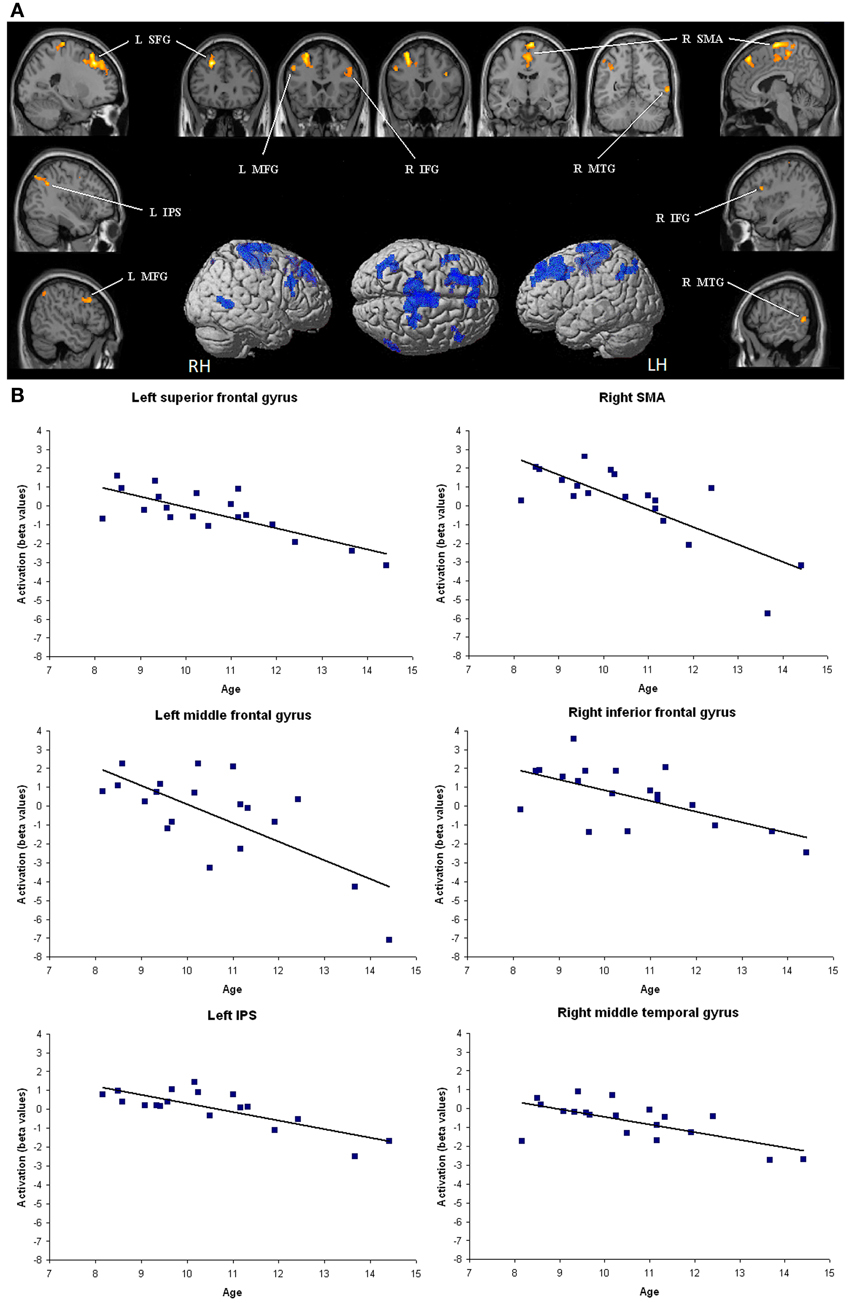 Frontiers | Neural correlates of the numerical distance effect in children