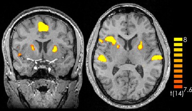 Frontiers | Play it again, Sam: brain correlates of emotional music ...
