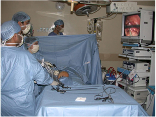 Frontiers | Redo Laparoscopic Pyeloplasty in Infants and Children ...