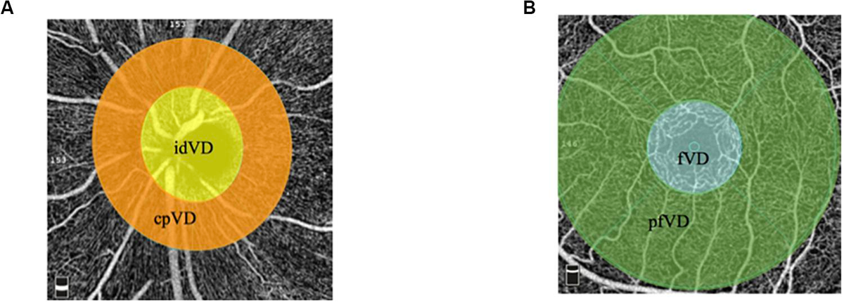 Frontiers | The Relationship Between Nailfold Microcirculation and ...