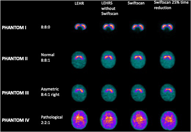 Frontiers | Faster Acquisition for Dopamine Transporter Imaging Using ...