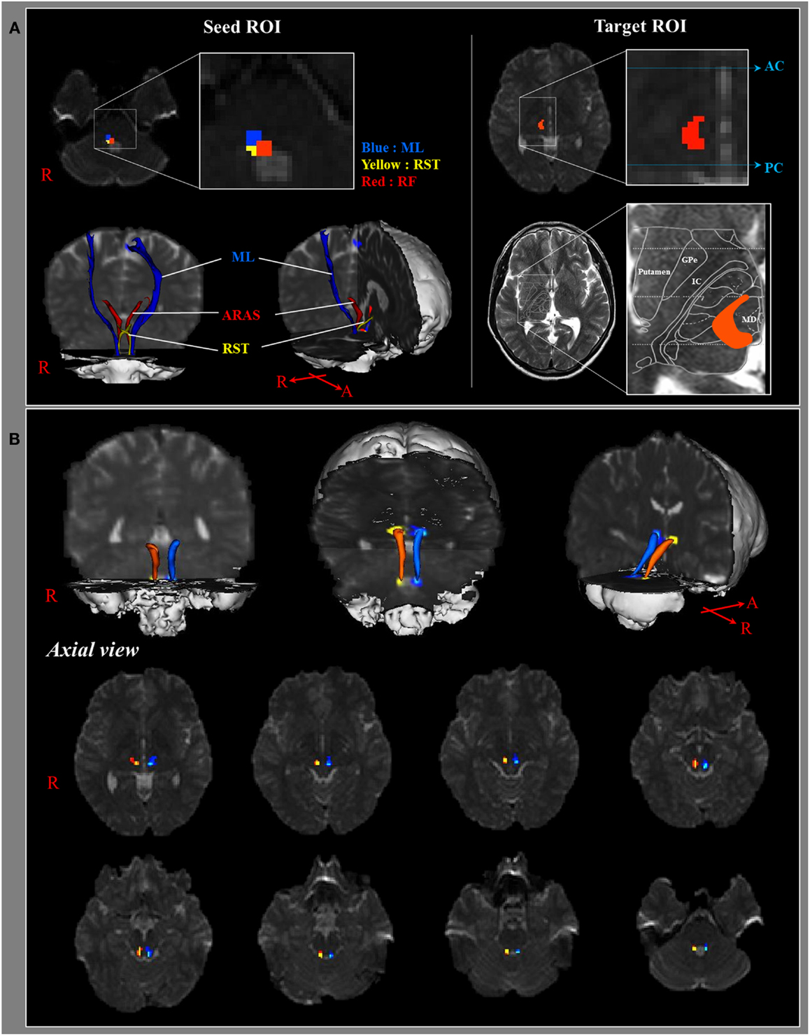Frontiers | The Ascending Reticular Activating System from Pontine ...