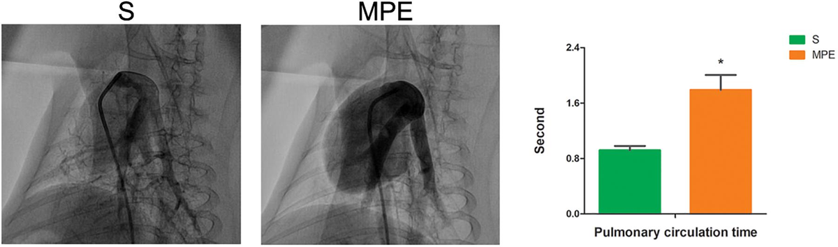 Frontiers | Association Between Inflammatory Mediators and Pulmonary ...