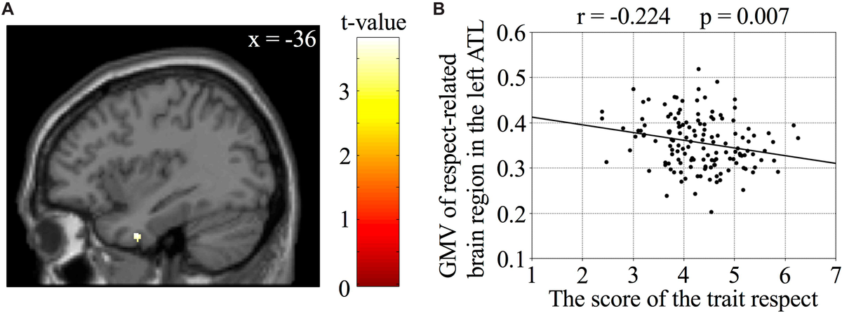 Frontiers | Trait Respect Is Linked to Reduced Gray Matter Volume in the Anterior Temporal Lobe